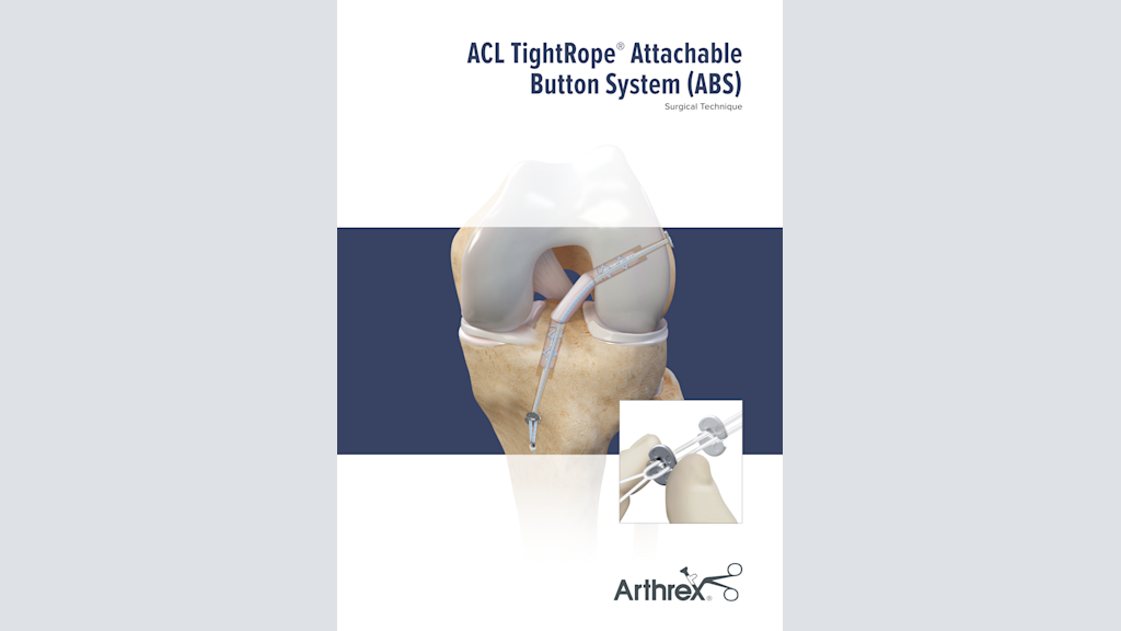 Arthrex - ACL TightRope® II Attachable Button System