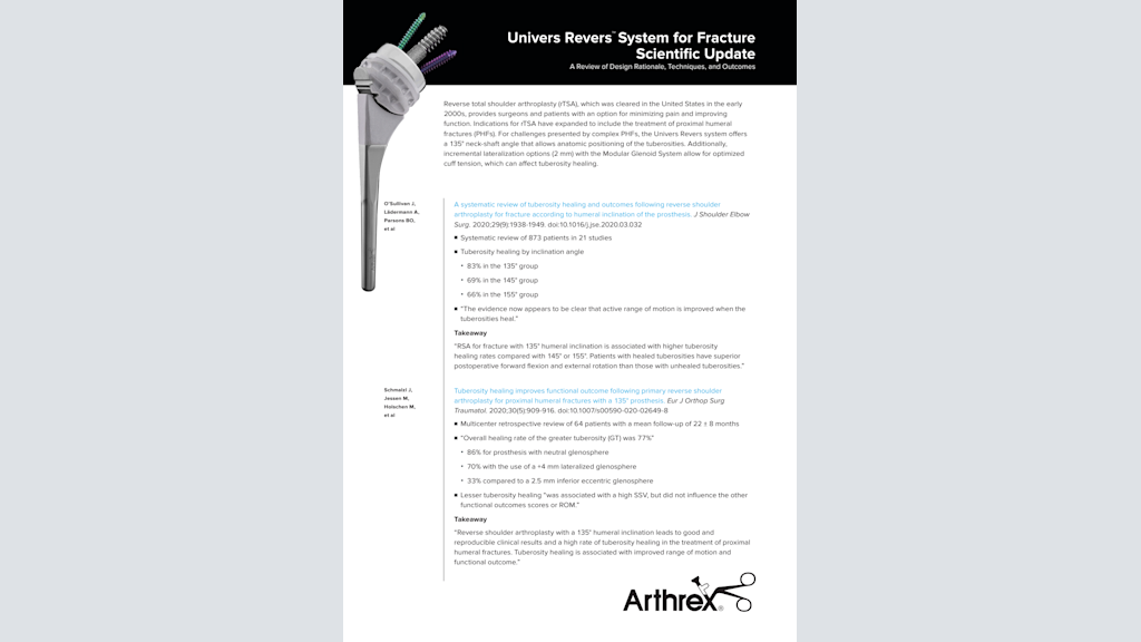 Arthrex - Univers Revers™ Total Shoulder System Arthrex - Univers Revers™ Total Shoulder System