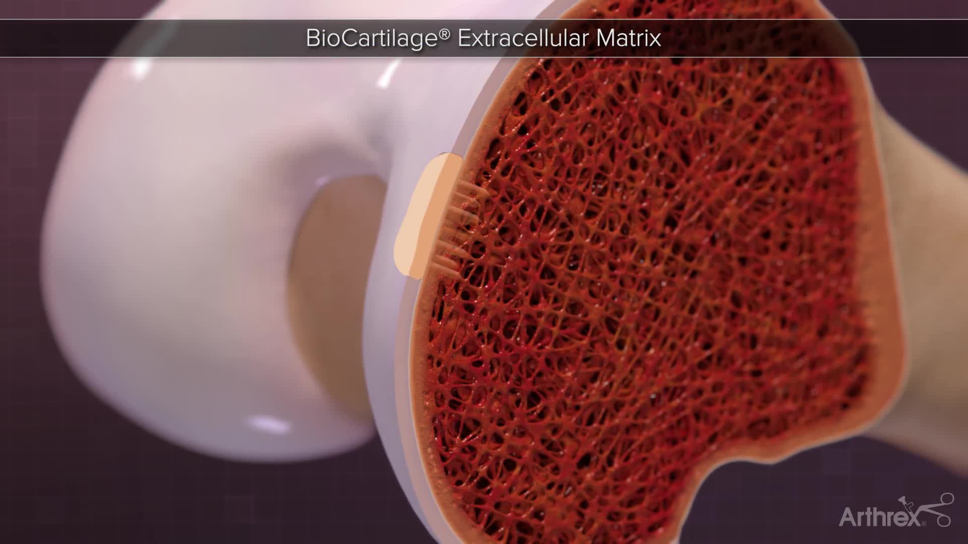 Arthrex Biocartilage® Extracellular Matrix