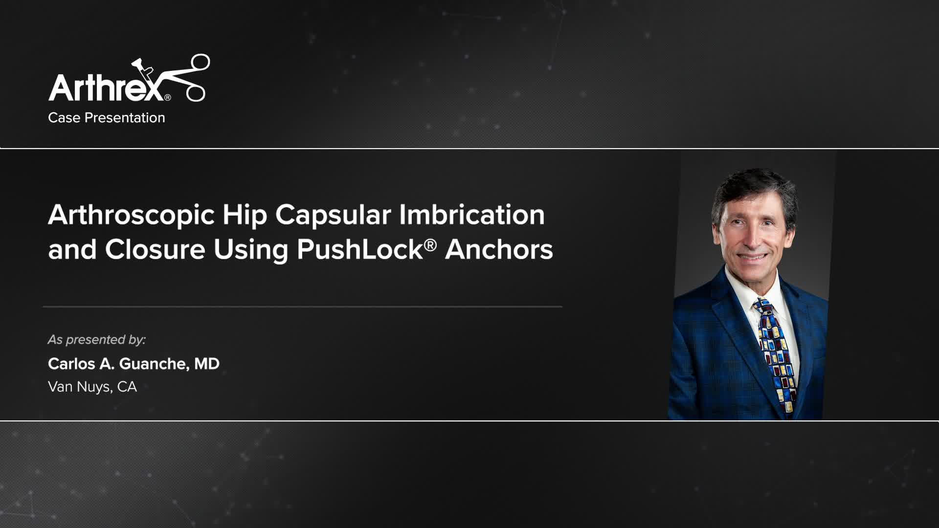 Arthrex Arthroscopic Hip Capsular Imbrication And Closure Using