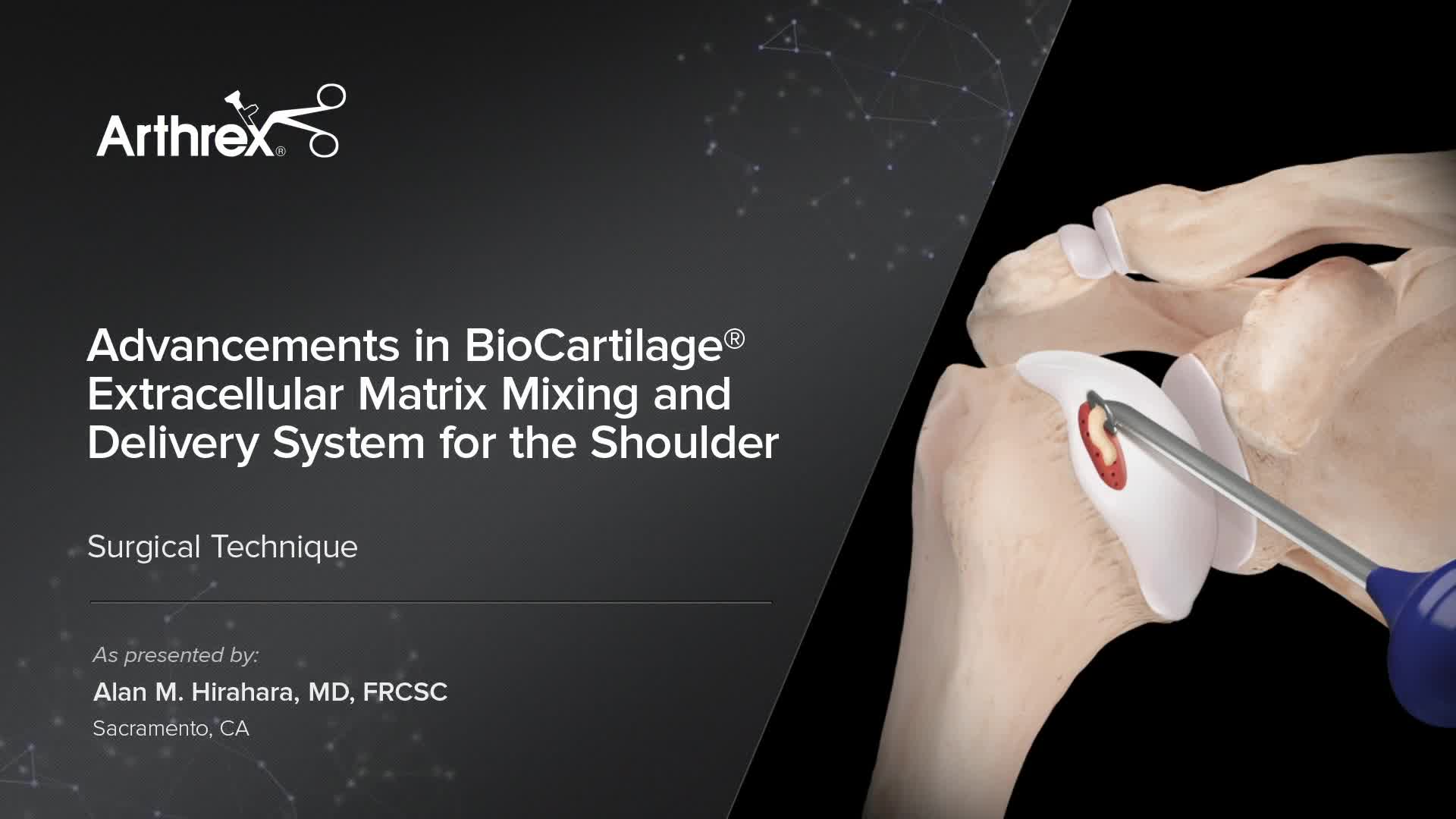 Arthrex Advancements In Biocartilage® Extracellular Matrix Mixing And Delivery System For The
