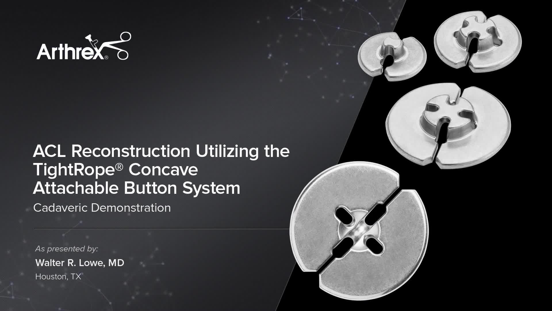 Arthrex - ACL Reconstruction Utilizing the TightRope® Concave ... Arthrex - ACL Reconstruction Utilizing the TightRope® Concave ...