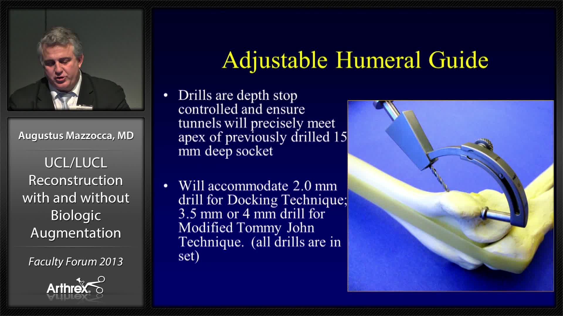 Arthrex Elbow Ucl Reconstruction Instrument Set
